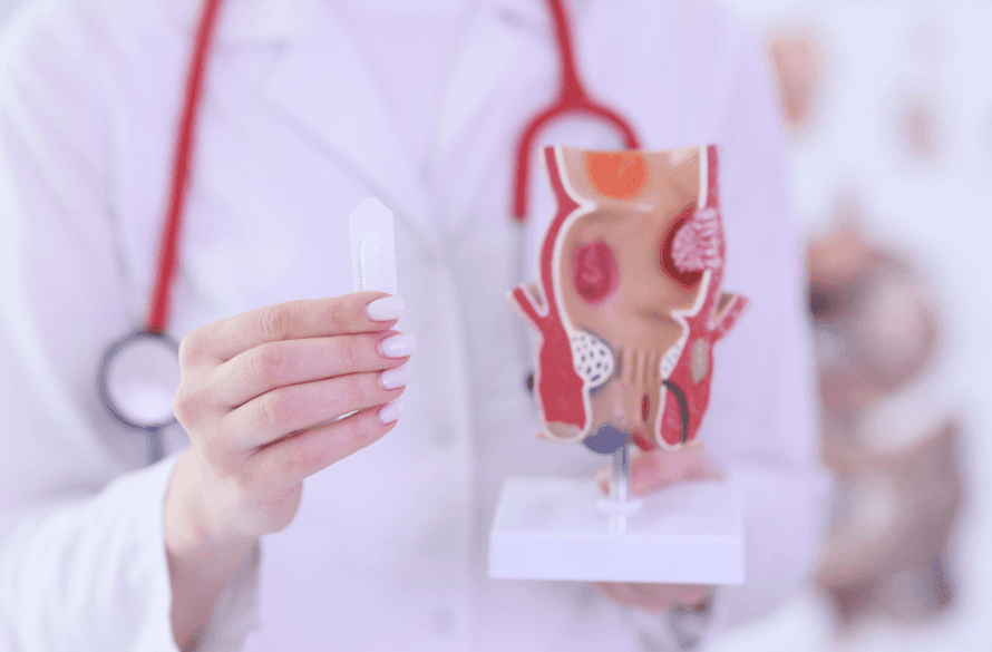 Haemorrhoids (Piles): Causes, Symptoms, Treatment and Cost